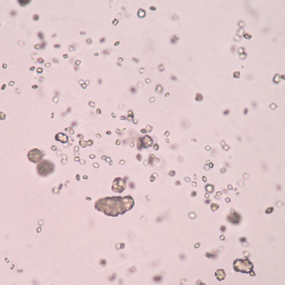 Hyperurikemie.cz | Komplexní informace o kyselině močové, dně a ...